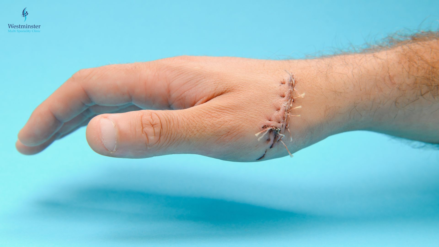 - Dubai Healthcare City | Westminster Ortho Med Clinic Suturing of ...